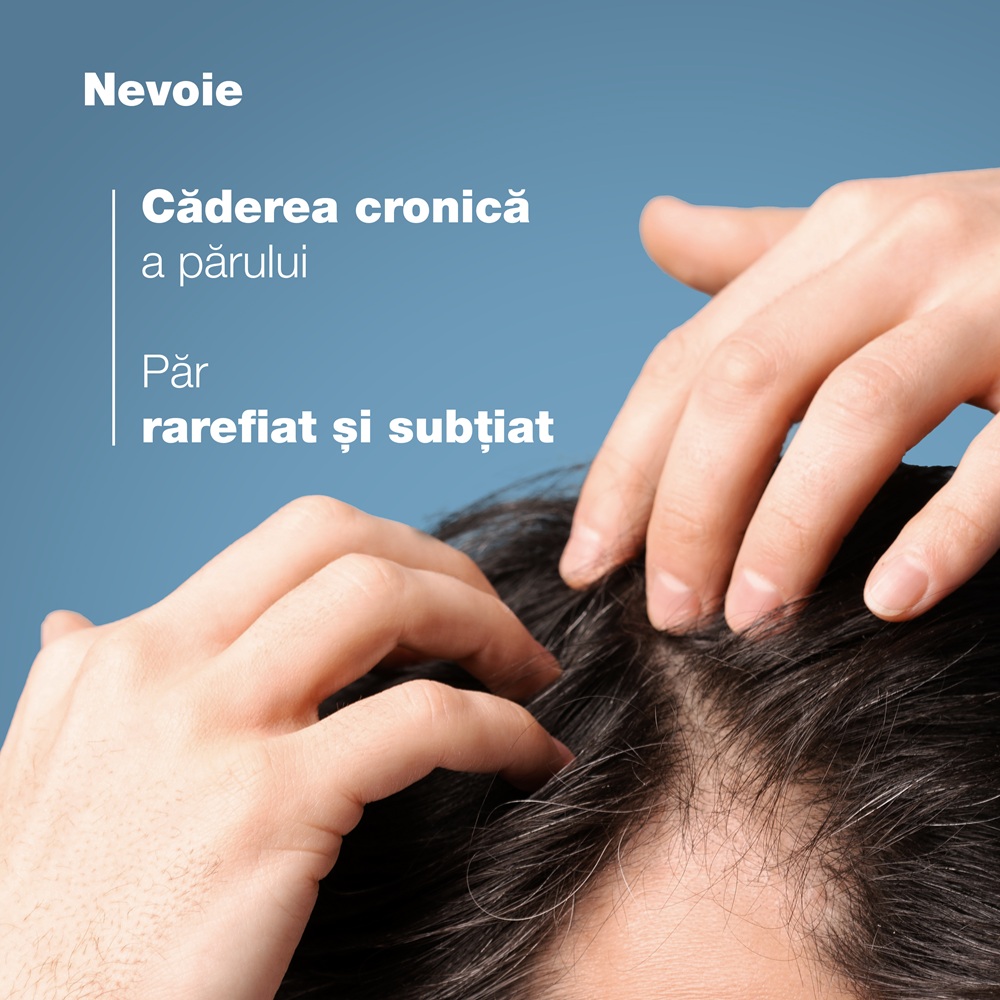 Sampon impotriva caderii parului Anaphase, 200 ml, Ducray : Farmacia Tei online